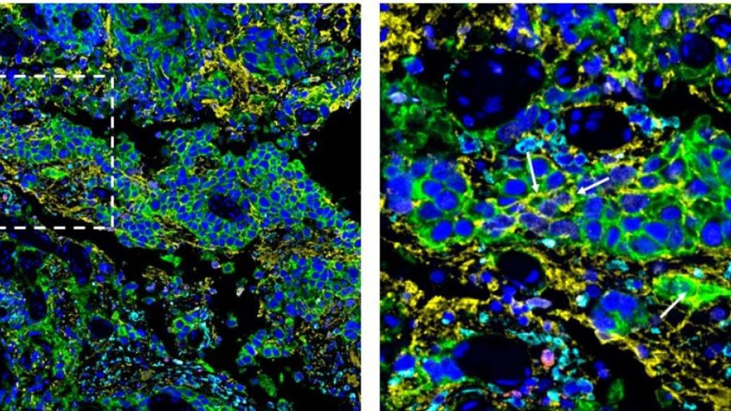 Benjamin Izar, MD, PhD | Herbert Irving Comprehensive Cancer Center ...