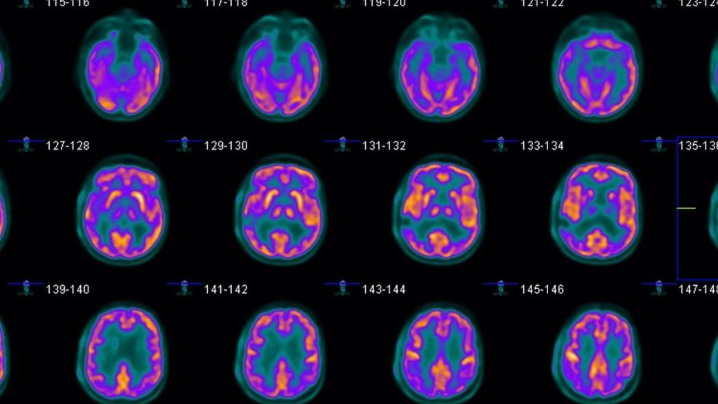 Benjamin Izar, MD, PhD | Herbert Irving Comprehensive Cancer Center ...