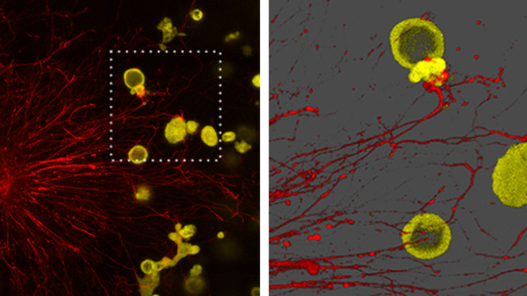 Timothy C Wang, MD | Herbert Irving Comprehensive Cancer Center (HICCC ...