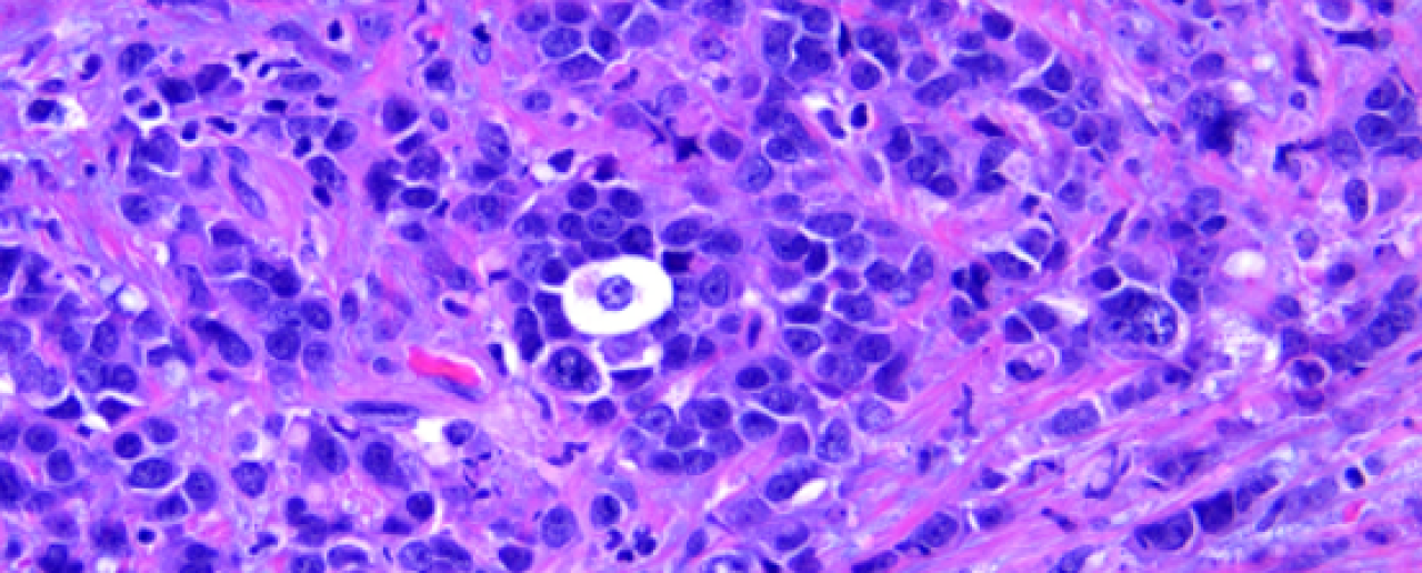 Gabre (CURE) Lab | Herbert Irving Comprehensive Cancer Center (HICCC ...