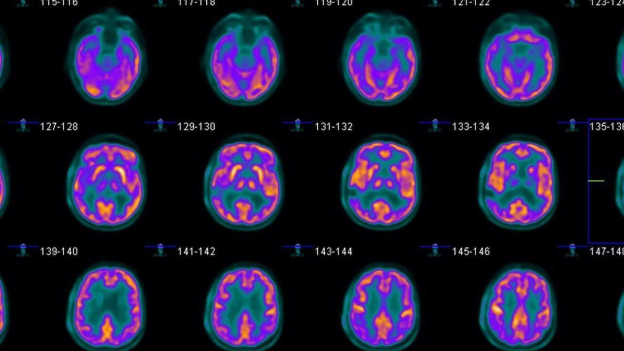 Benjamin Izar, MD, PhD | Herbert Irving Comprehensive Cancer Center ...