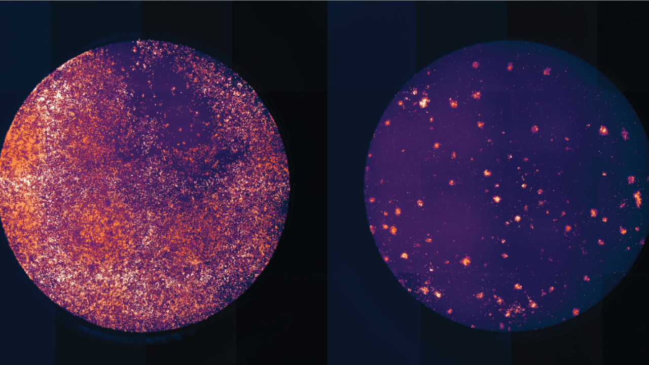Improving cell therapy by creating T-cell “super soldiers” | Herbert ...