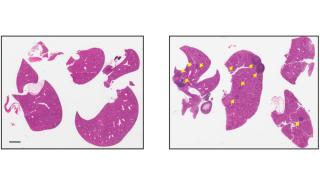 Benjamin Izar, MD, PhD | Herbert Irving Comprehensive Cancer Center ...