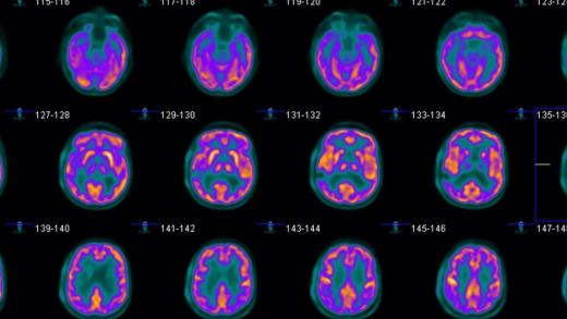 Benjamin Izar, MD, PhD | Herbert Irving Comprehensive Cancer Center ...