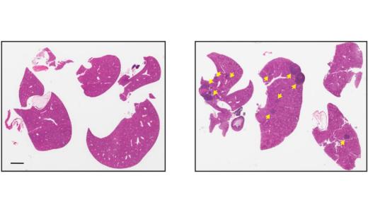 Benjamin Izar, MD, PhD | Herbert Irving Comprehensive Cancer Center ...
